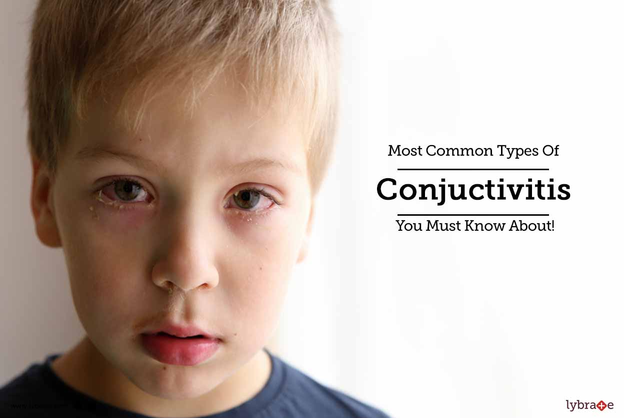 Most Common Types Of Conjuctivitis You Must Know About! - By Dr. Ruchi ...