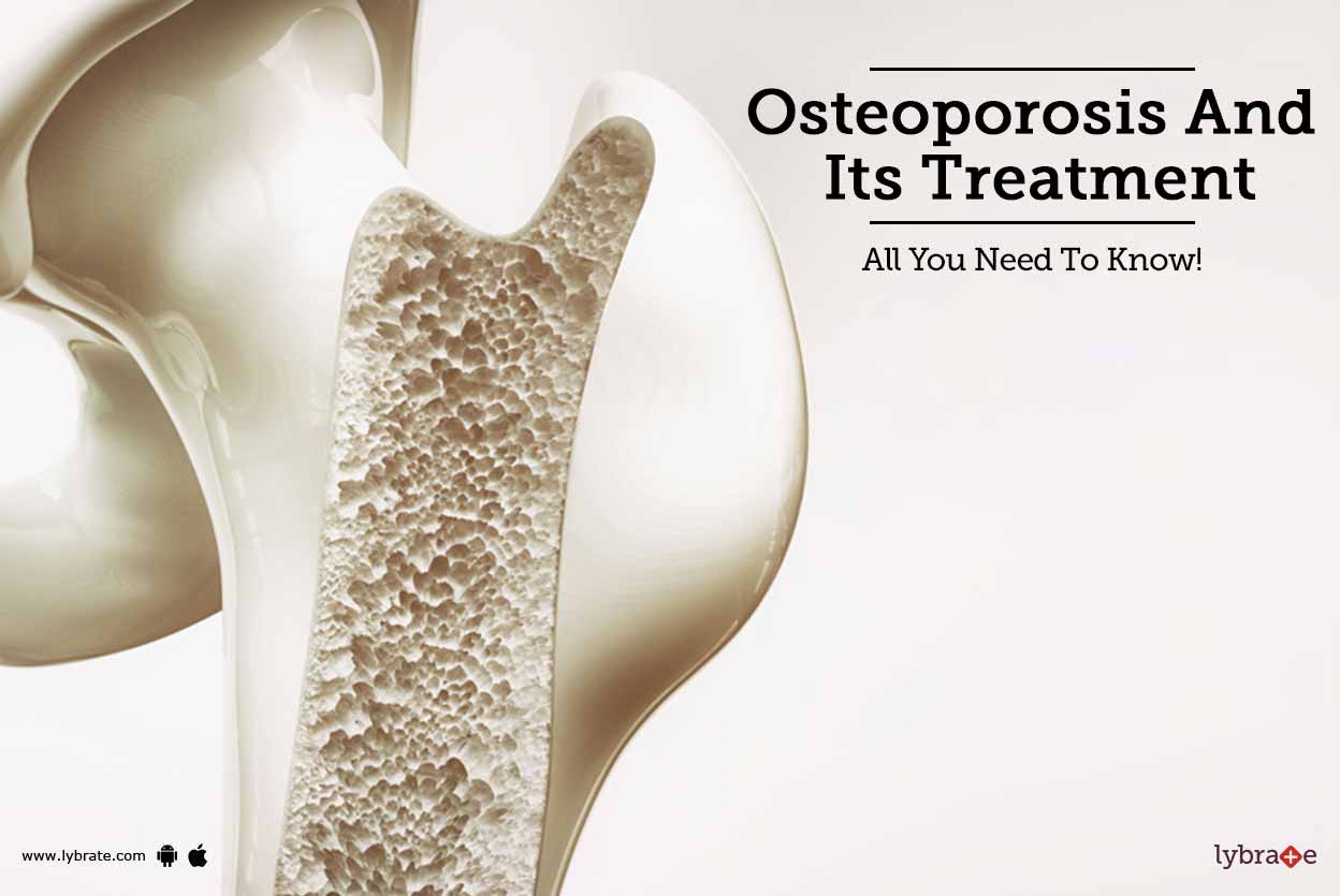 Osteoporosis And Its Treatment - All You Need To Know! - By Dr. Lekhraj ...