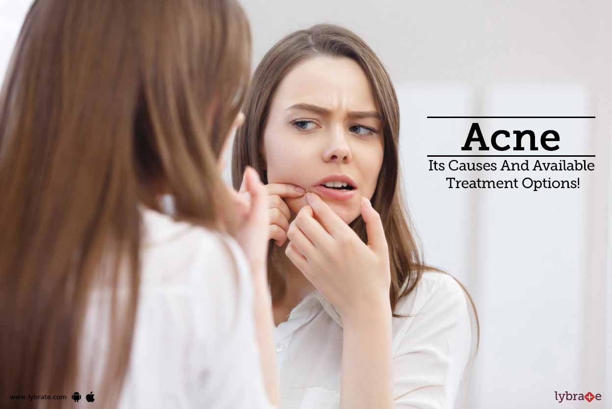 Acne - Its Causes And Available Treatment Options! - By Dr. Satish ...