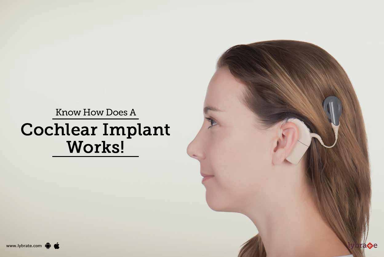 Know How Does A Cochlear Implant Works! - By Dr. Sanjay Kumar Gudwani ...