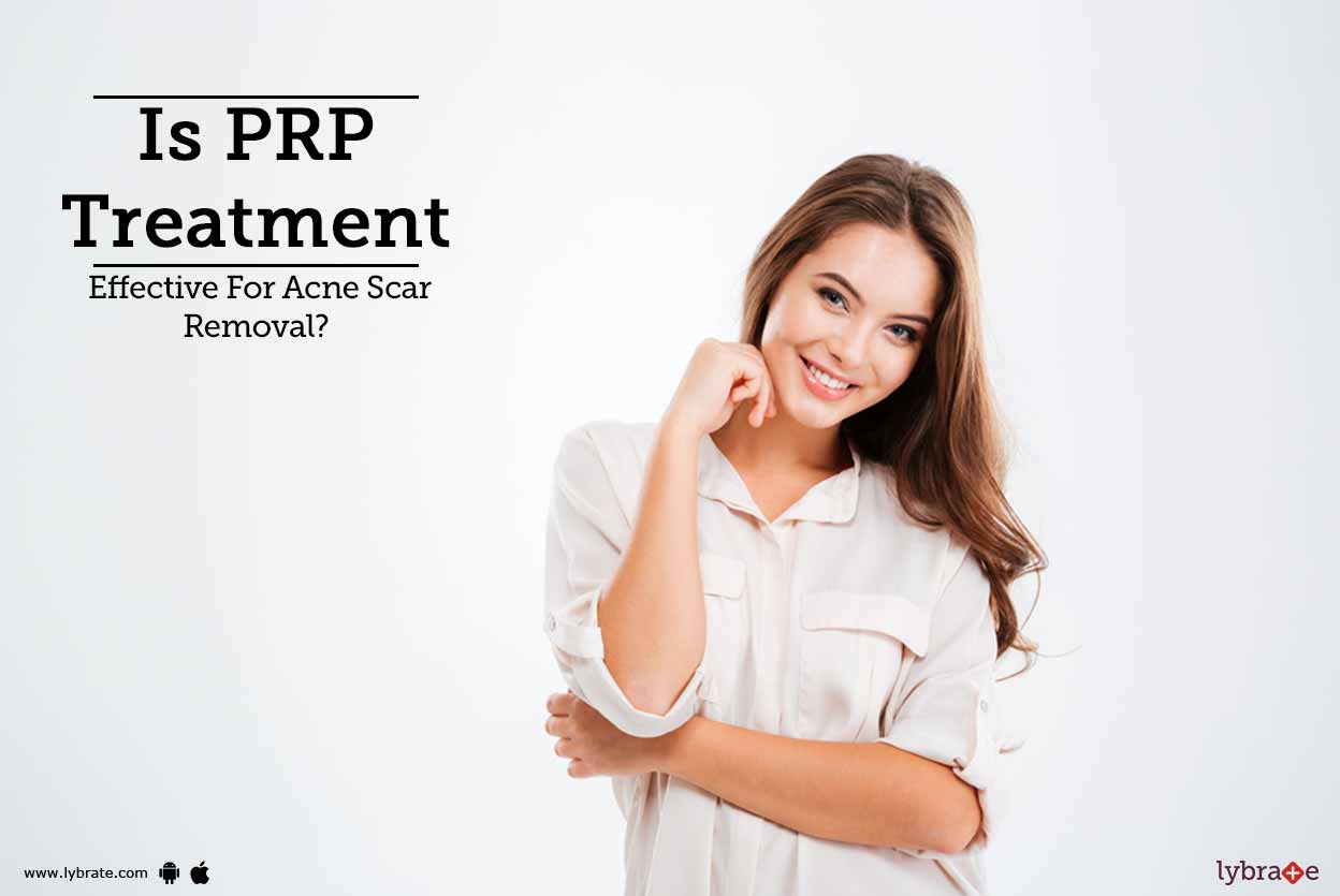 Is PRP Treatment Effective For Acne Scar Removal? - By Hairline ...