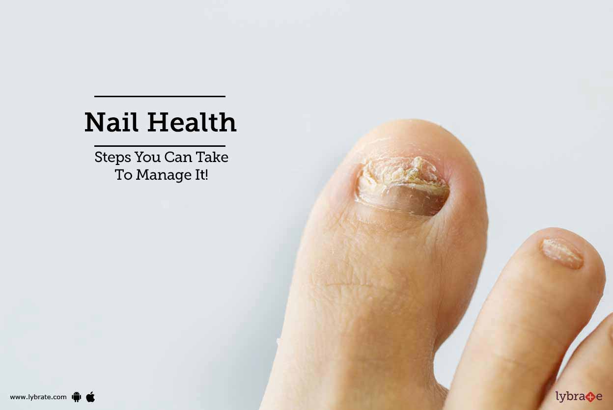 Nail Health - Steps You Can Take To Manage It! - By Dr. Vivek Kumar Dey ...