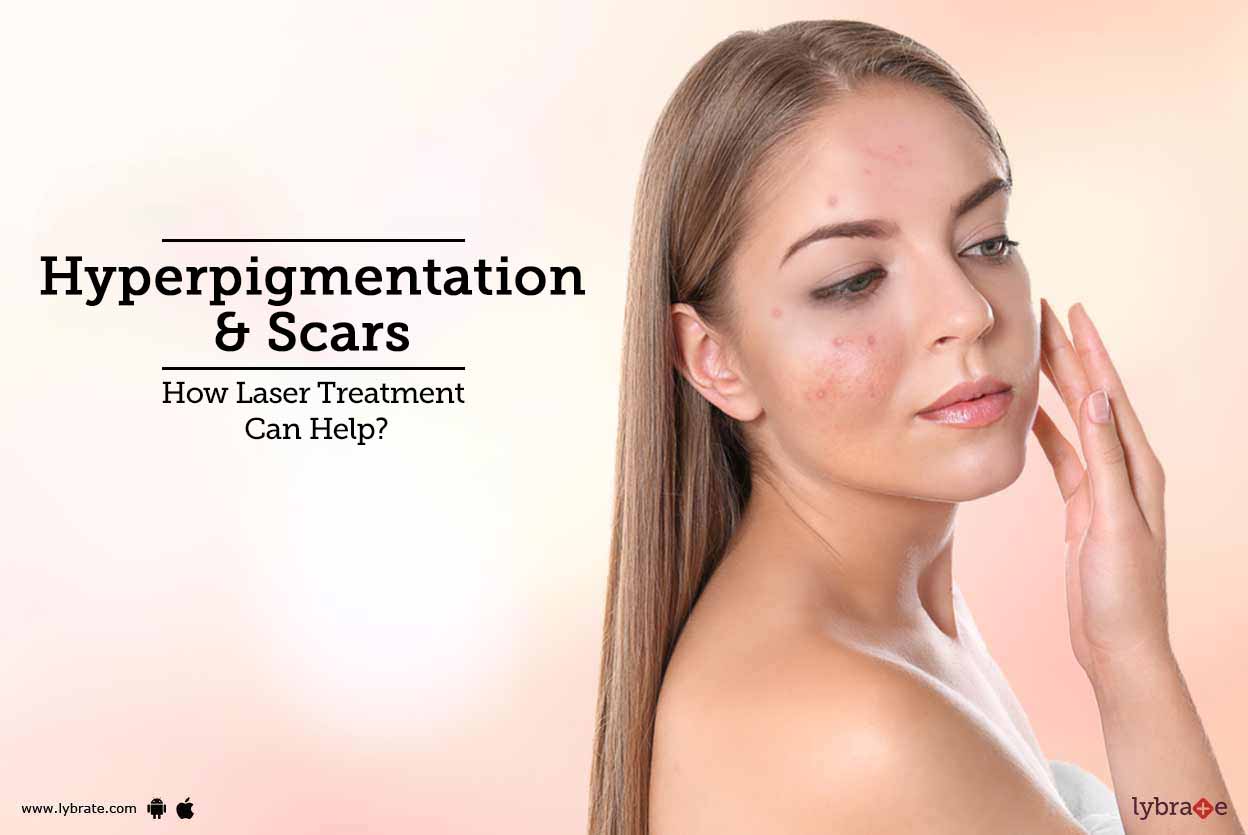 Hyperpigmentation & Scars - How Laser Treatment Can Help? - By Dr ...