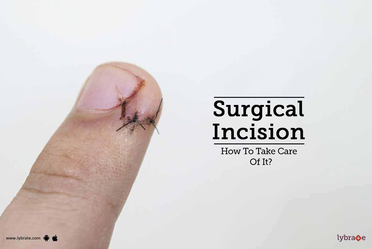 Surgical Incision - How To Take Care Of It? - By Dr. Sharad Daga | Lybrate