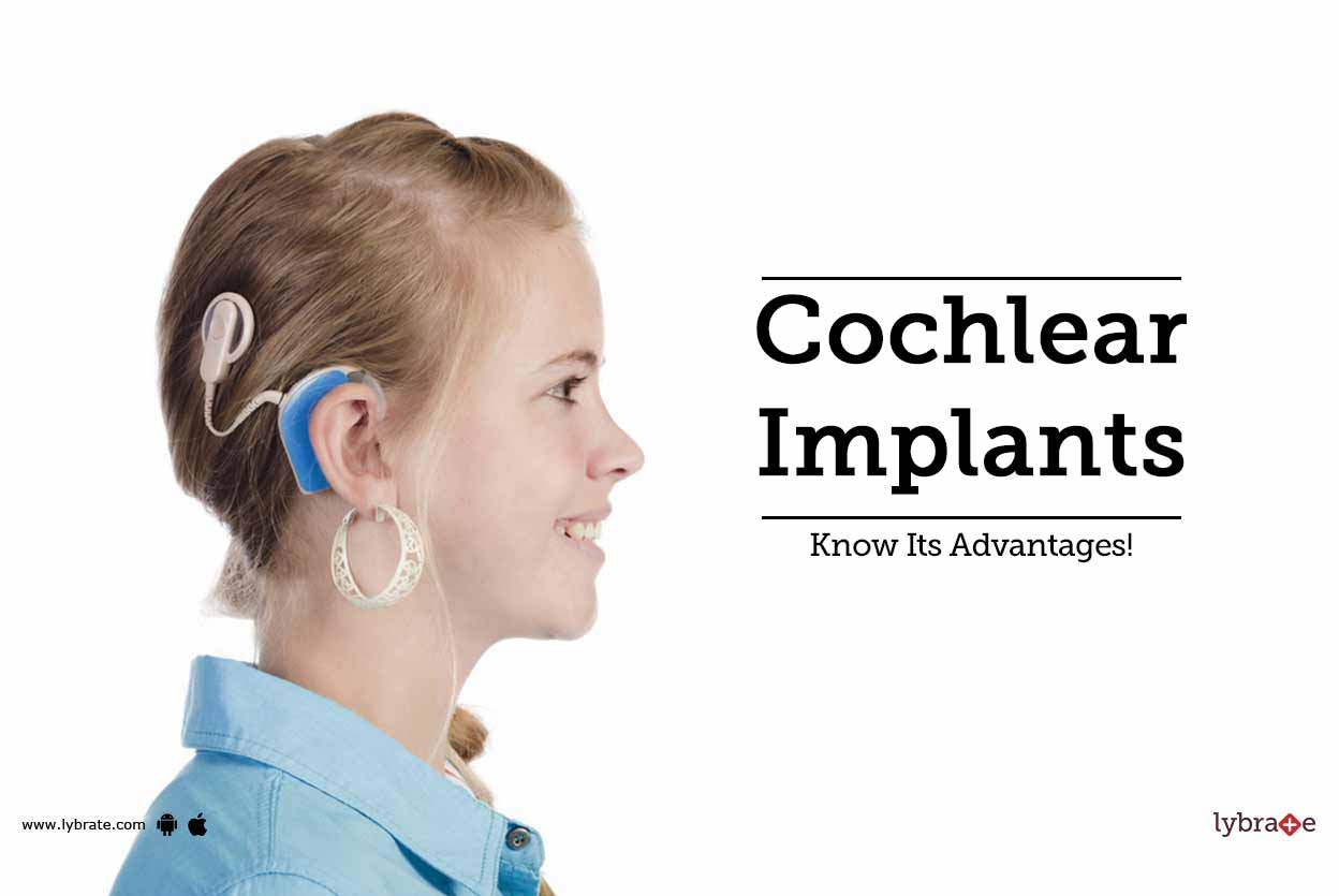 Cochlear Implants - Know Its Advantages! - By Dr. Anjali Upadhyay | Lybrate