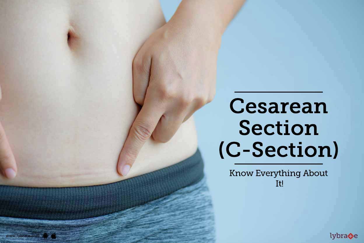 Cesarean Section (C-Section) - Know Everything About It! - By ...