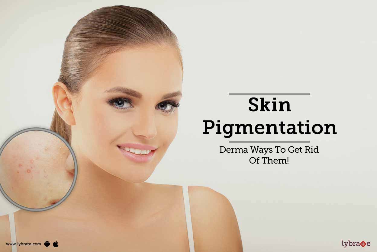 Skin Pigmentation - Derma Ways To Get Rid Of Them! - By Dr. Bhavuk ...