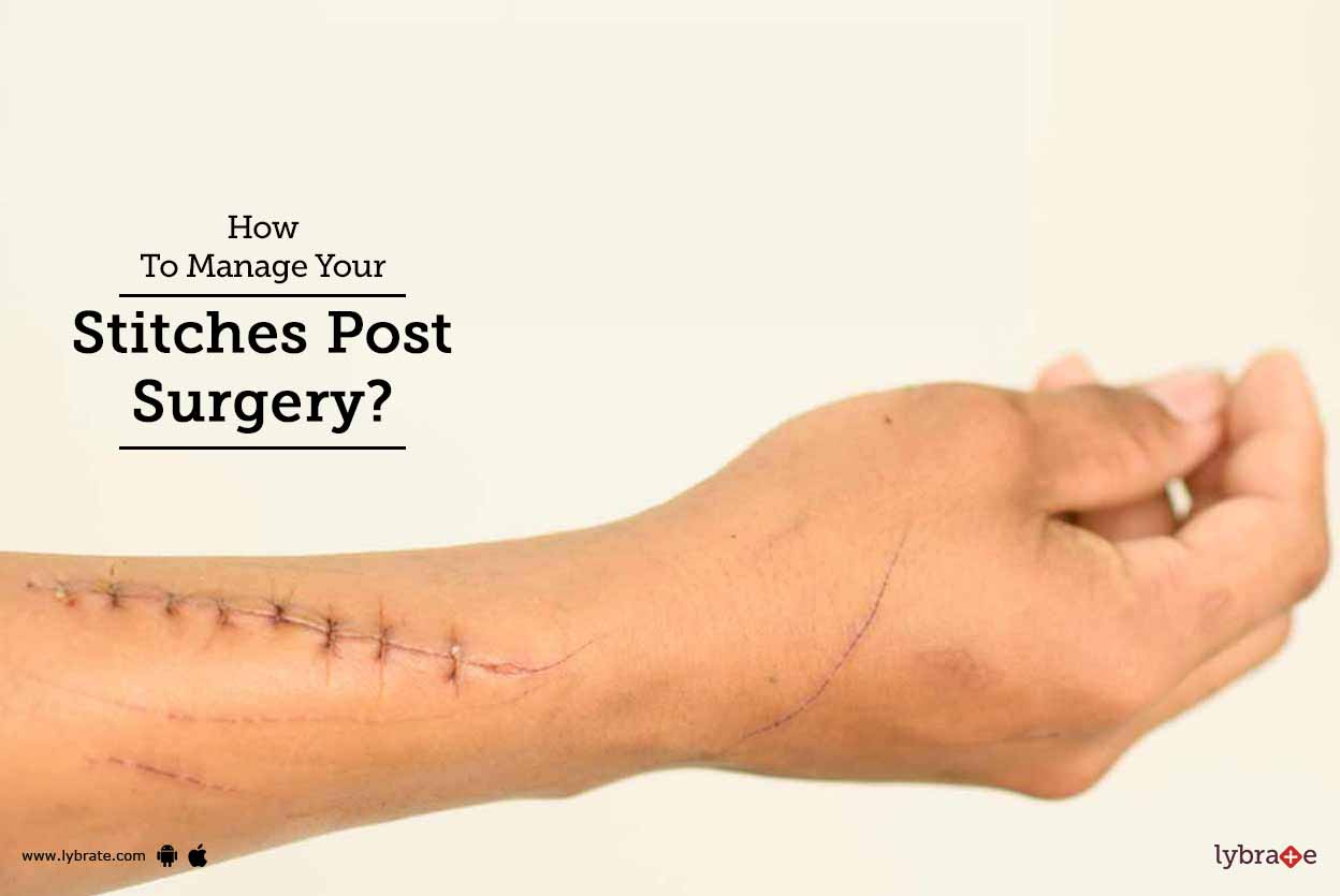 How To Manage Your Stitches Post Surgery? - By Dr. Amitava Chakraborty ...