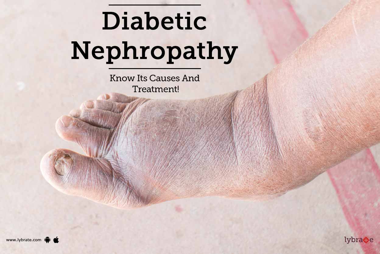 Diabetic Nephropathy - Know Its Causes And Treatment! - By Dr. Tauhidul ...