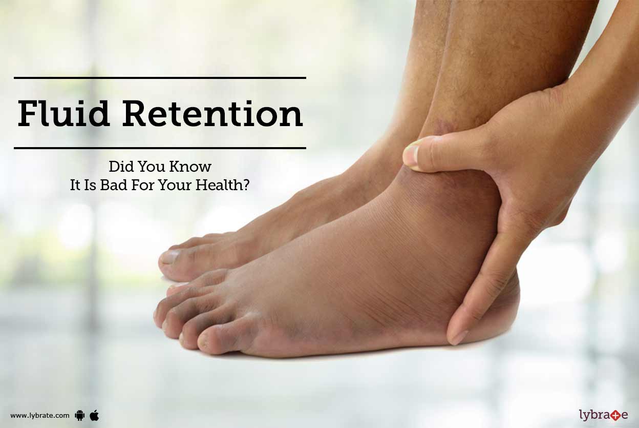 Fluid Retention - Did You Know It Is Bad For Your Health? - By Dr ...