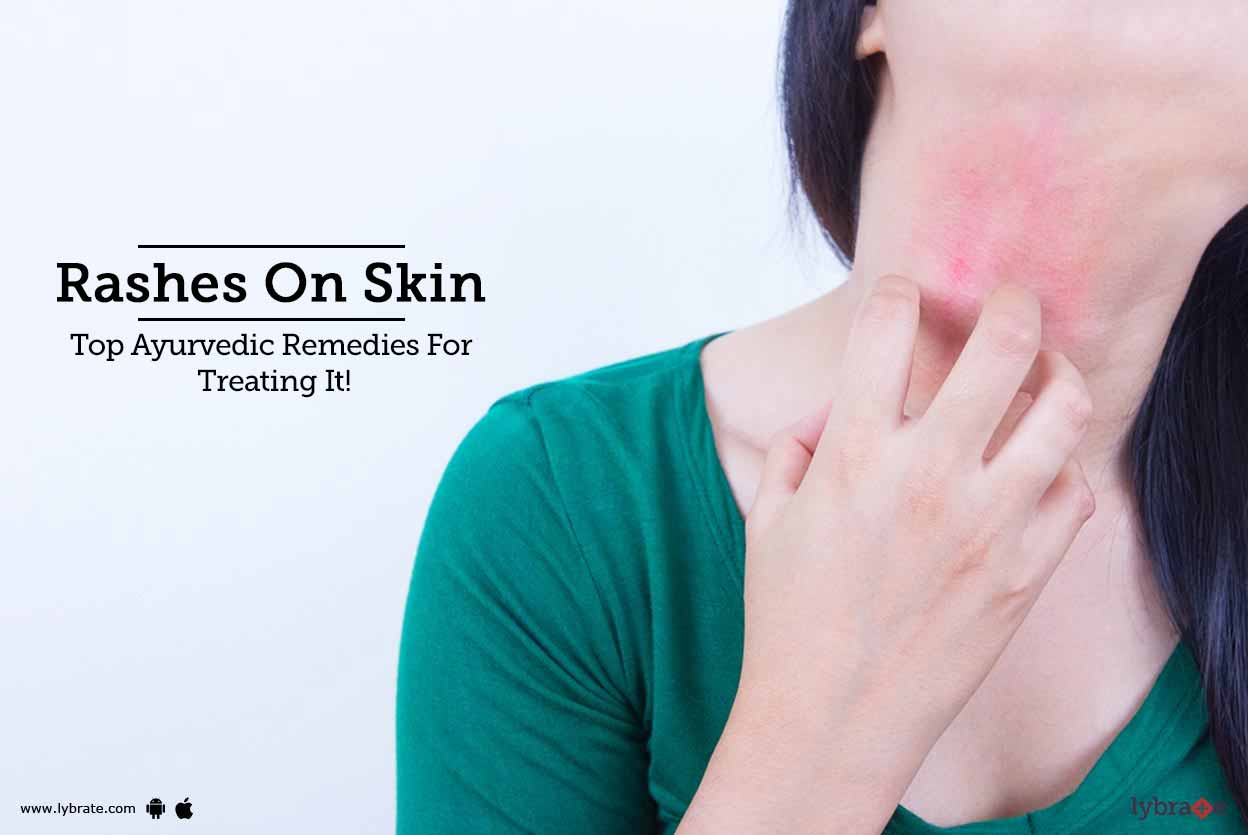 Rashes On Skin - Top Ayurvedic Remedies For Treating It! - By Dr ...