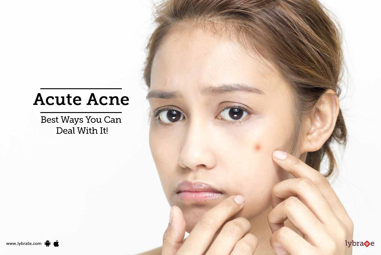 Acute Acne - Best Ways You Can Deal With It! - By Elite Aesthetic ...