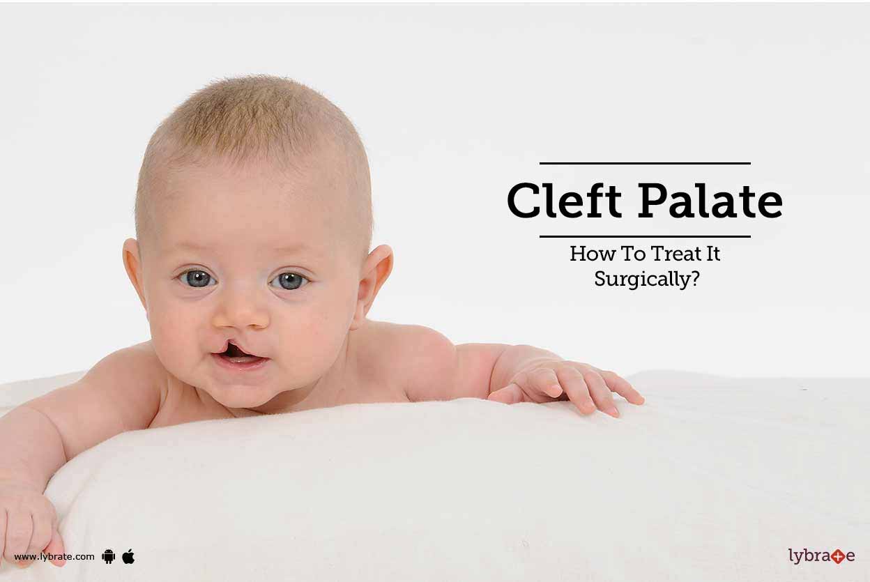 Cleft Palate - How To Treat It Surgically? - By Dr. Abhilash Chokshi ...