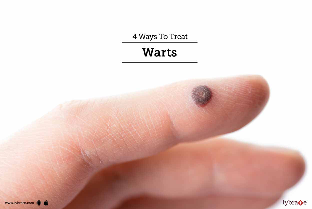 4 Ways To Treat Warts - By Dr. Jatin Sharma | Lybrate