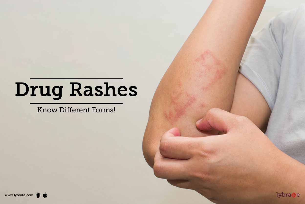 Drug Rashes - Know Different Forms! - By Dr. Deepti Shrivastava | Lybrate