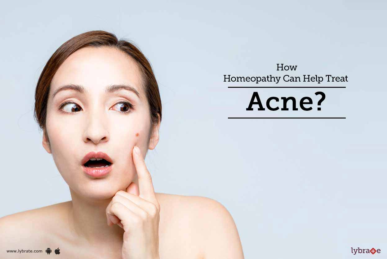 How Homeopathy Can Help Treat Acne? - By Dr. Srinivas Kornepati | Lybrate