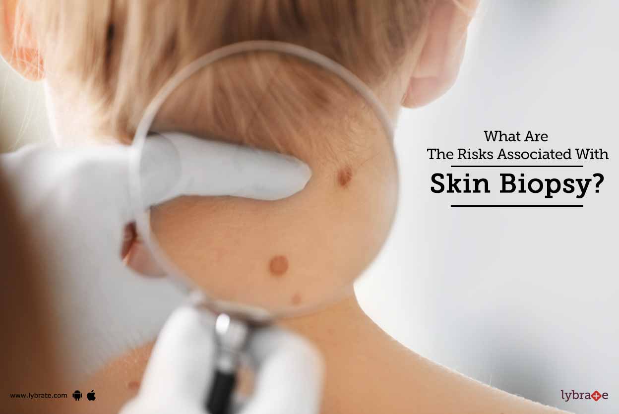 What Are The Risks Associated With Skin Biopsy? - By Dr. Anvika Mittal ...