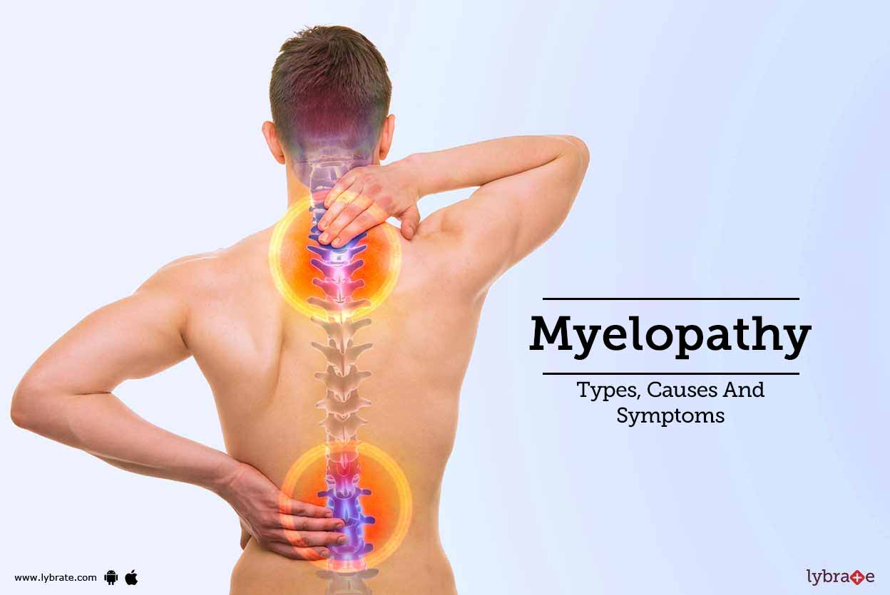 Myelopathy - Types, Causes And Symptoms - By Dr. Hamayun Ahad | Lybrate