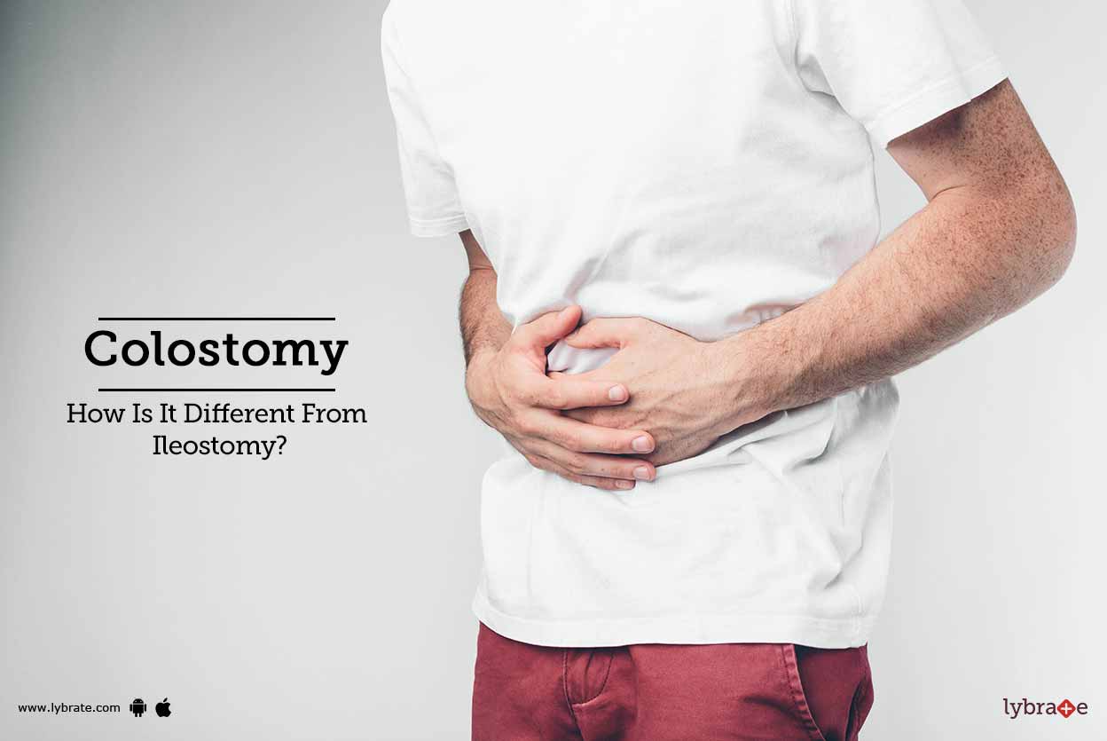 Colostomy - How Is It Different From Ileostomy? - By Dr. Bhagyesh Patel ...