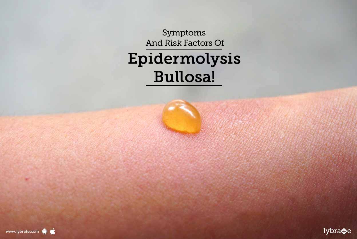 Symptoms And Risk Factors Of Epidermolysis Bullosa! - By Dr. Brinda ...