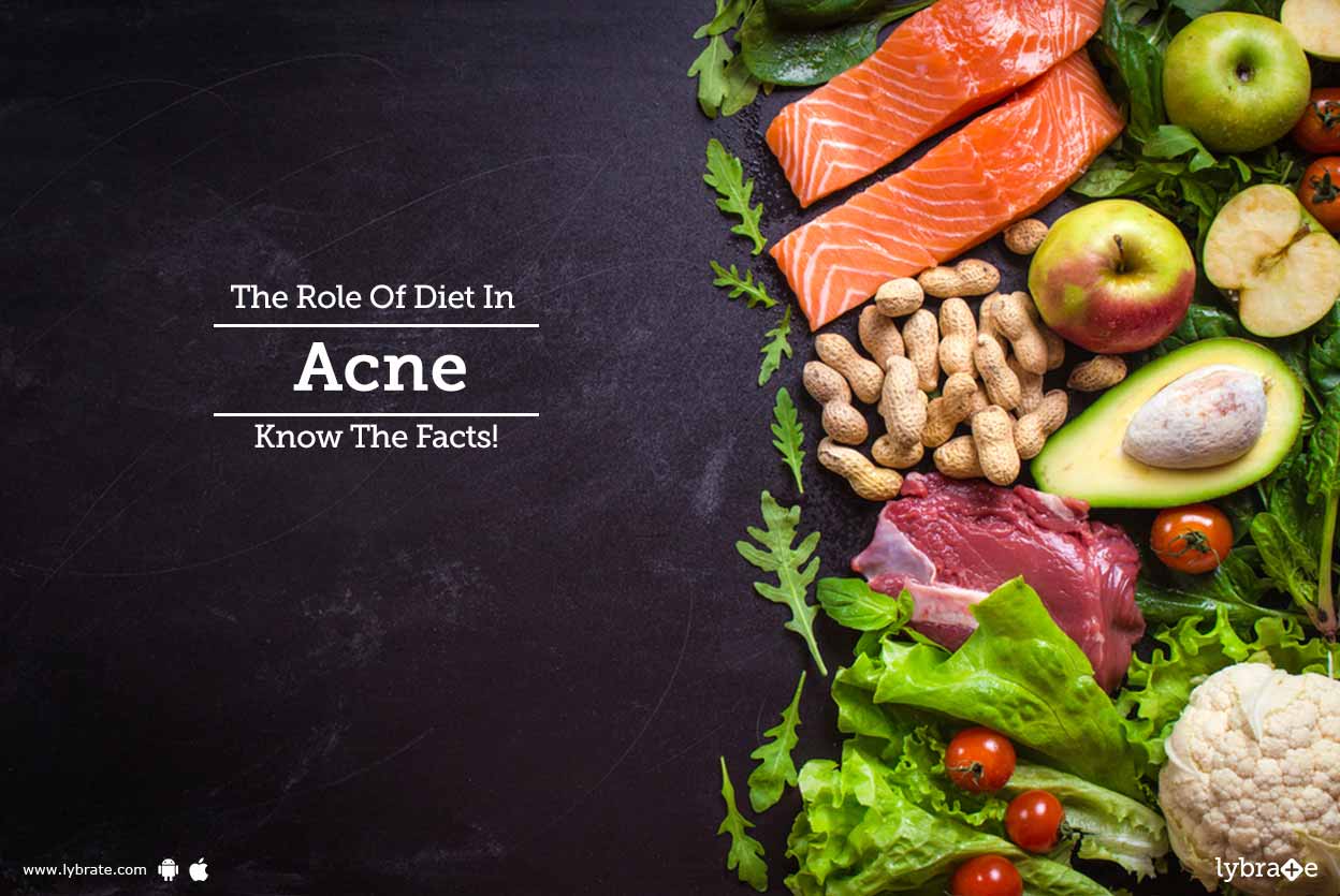 The Role Of Diet In Acne - Know The Facts! - By Dr. Rajeev Jain | Lybrate