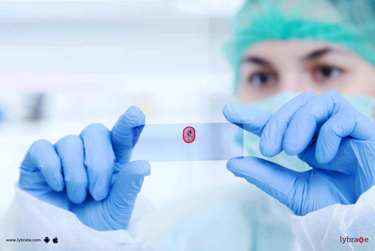 Biopsy 5 Things Every Patient Should Know Different Types Of Lung ...