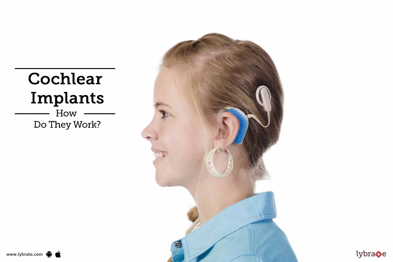 Cochlear Implants - How Do They Work? - By Dr. Sadat Qureshi | Lybrate