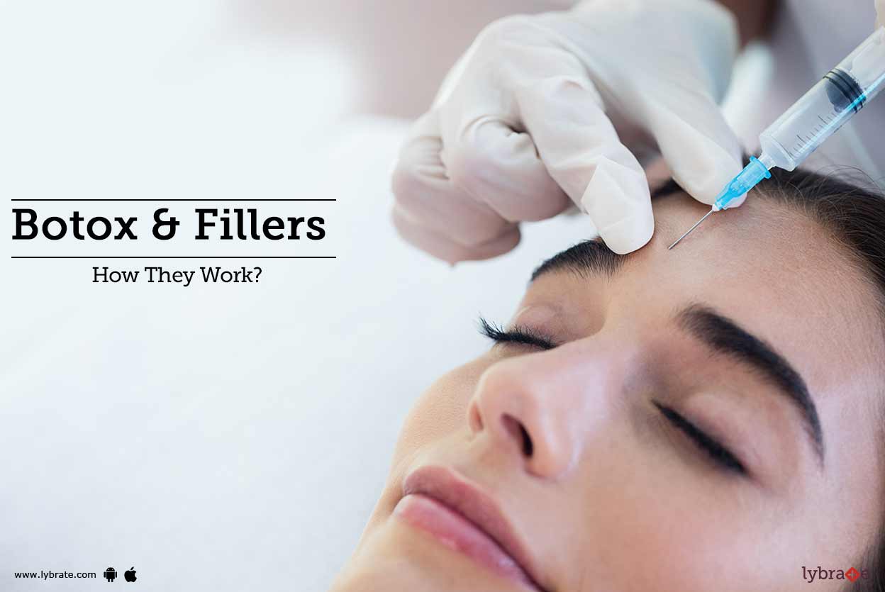 Botox & Fillers - How They Work? - By Dr. S. K Chawla | Lybrate