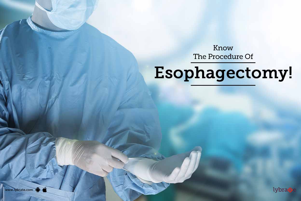 Know The Procedure Of Esophagectomy! - By Dr. C.S. Ramachandran | Lybrate