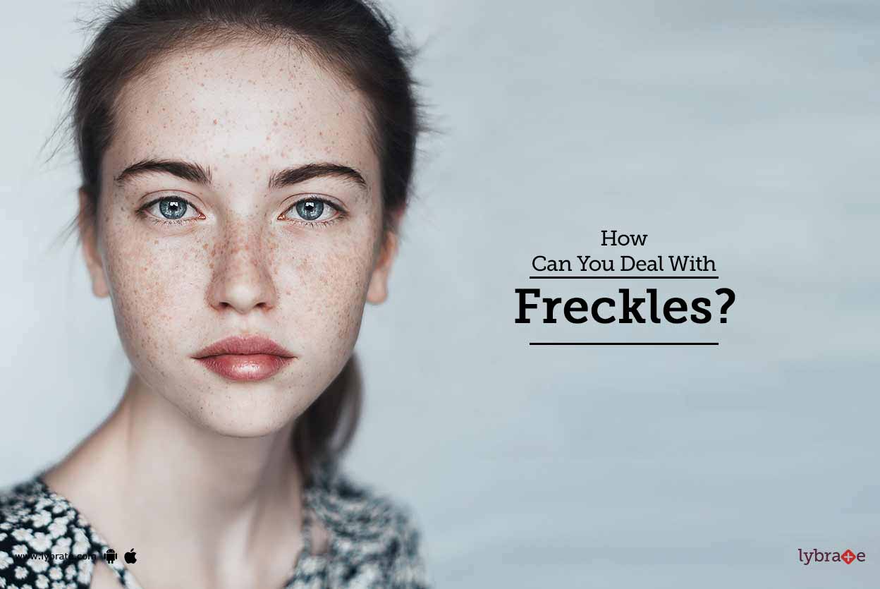 How Can You Deal With Freckles? - By Dr. Saurabh Sharma | Lybrate