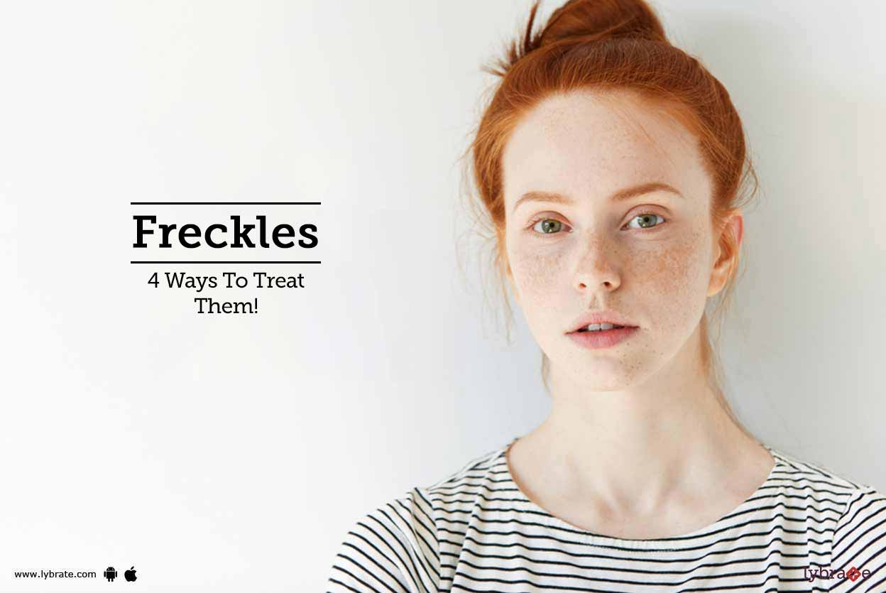 Freckles - 4 Ways To Treat Them! - By Sakhiya Skin Clinic Private ...