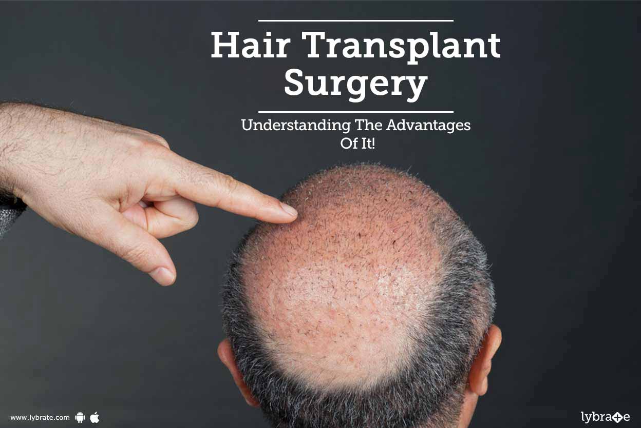 Hair Transplant Surgery - Understanding The Advantages Of It! - By Dr ...