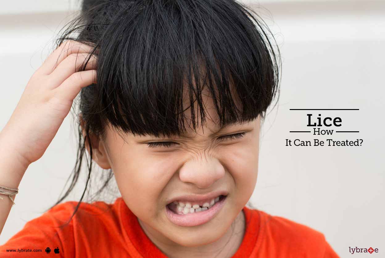 Lice - How It Can Be Treated? - By Dr. Nitin Jain | Lybrate