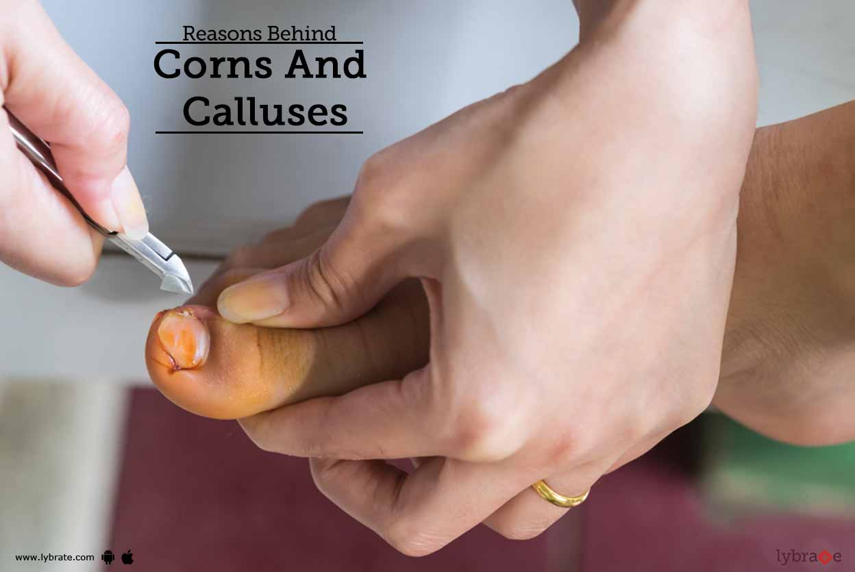 Reasons Behind Corns And Calluses - By Dr. Sanchit Talwar | Lybrate