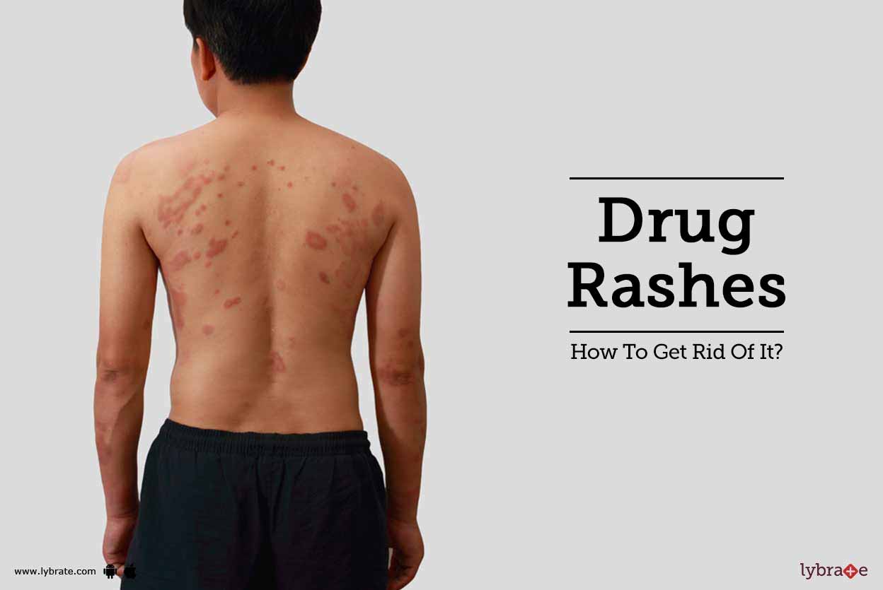 Drug Rashes - How To Get Rid Of It? - By Abhivrit Aesthetics | Lybrate