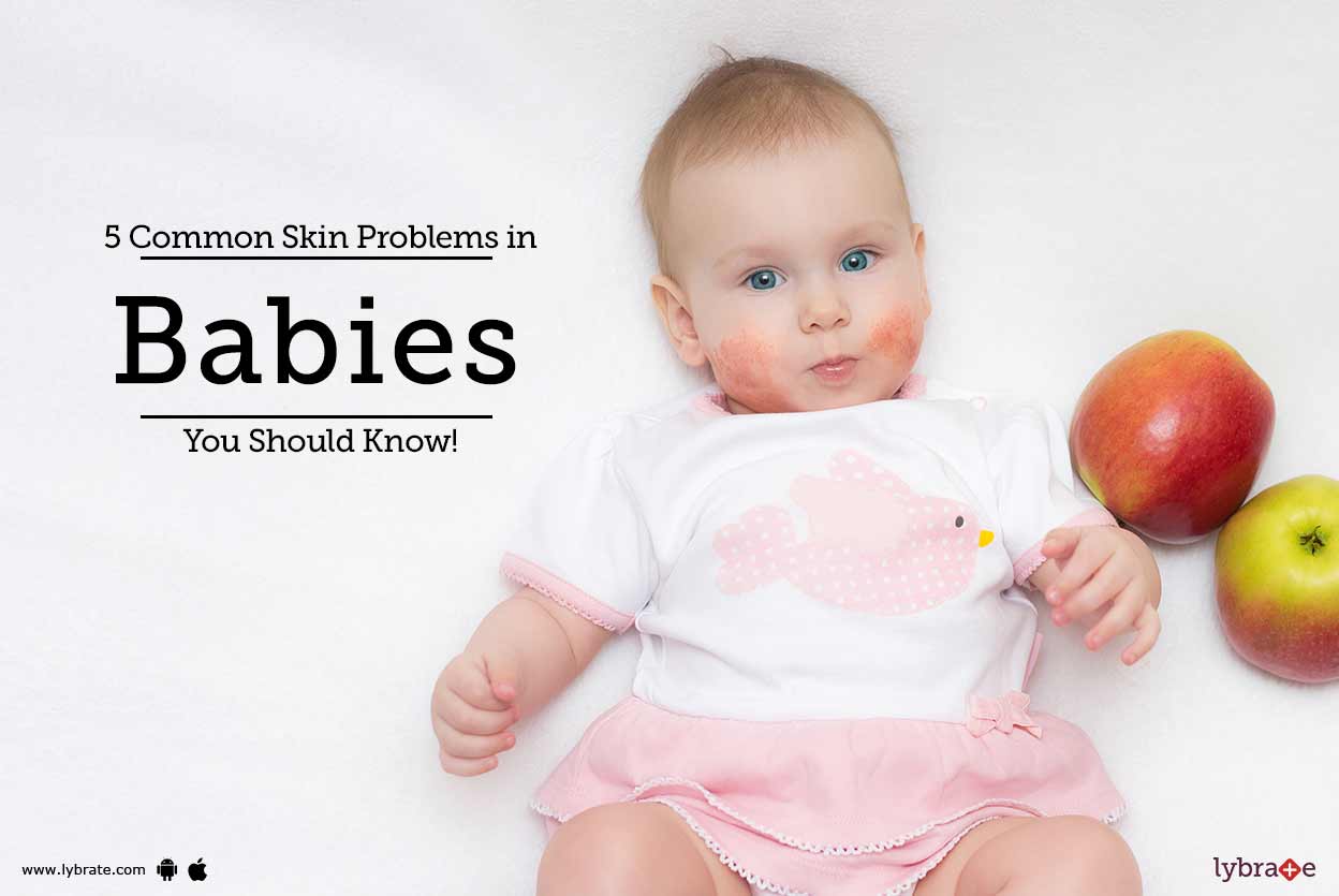 5 Common Skin Problems in Babies You Should Know! - By Dr. Jolly Shah ...