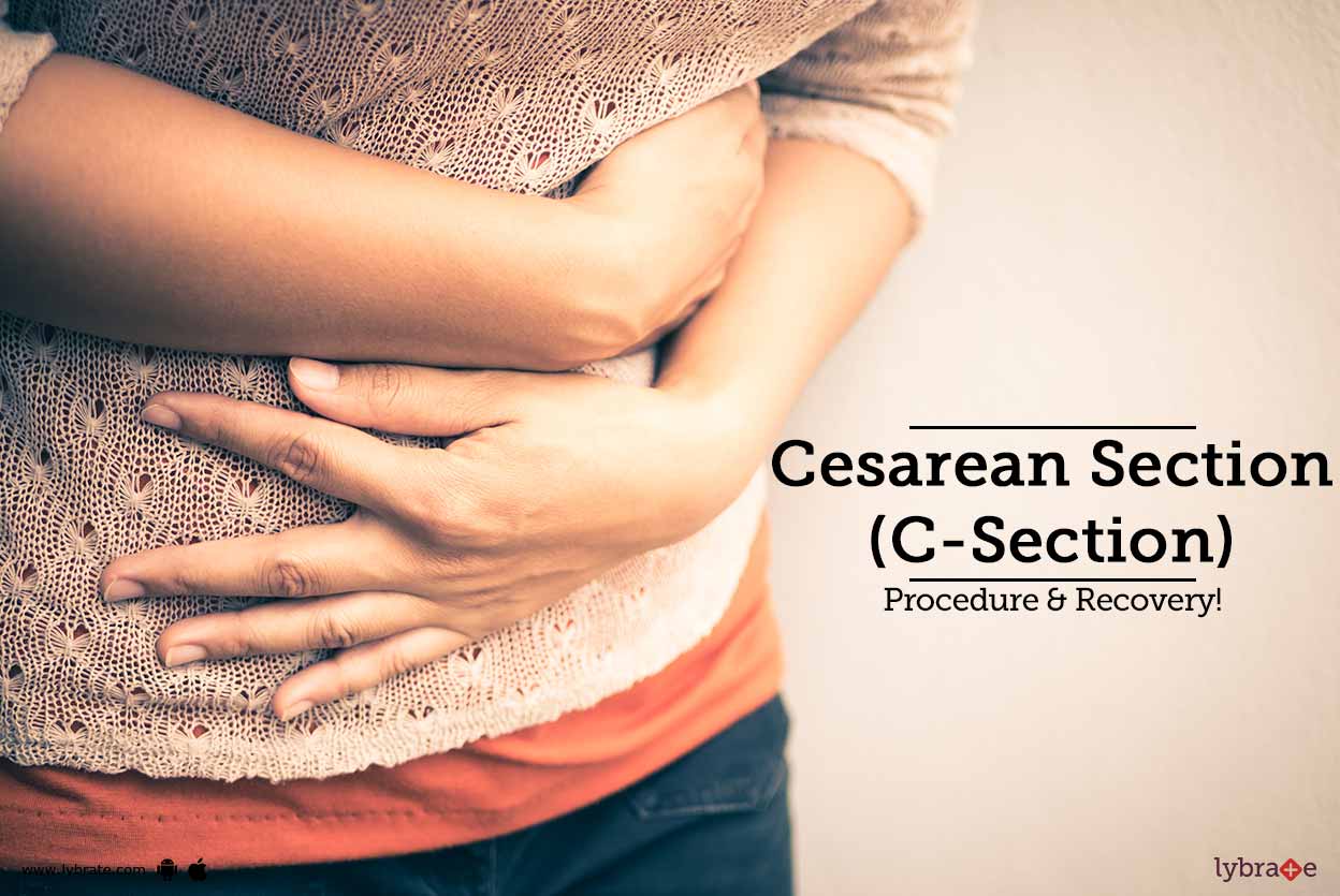 Cesarean Section (C-Section) - Procedure & Recovery! - By Dr. Nidhi ...