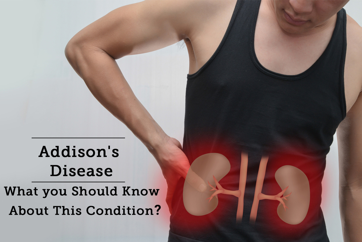 Addison's Disease: What You Should Know About This Condition? - By Dr ...