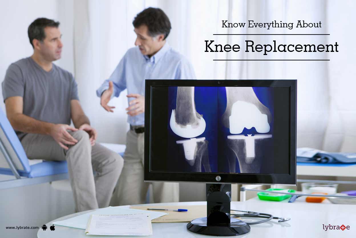 Know Everything About Knee Replacement - By Dr. Rakesh G. Nair Nair ...