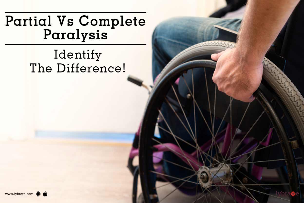 Paraplegia Vs Paraparesis