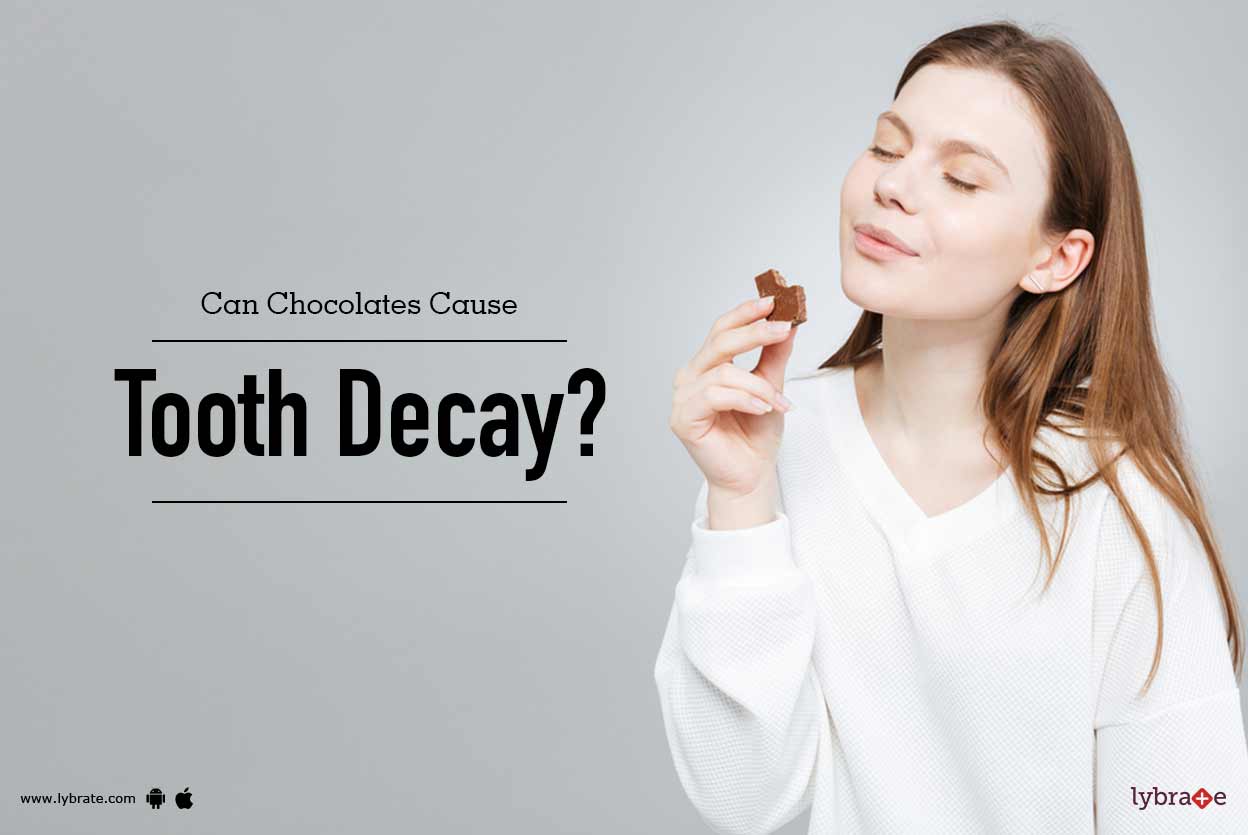 Can Chocolates Cause Tooth Decay? - By Dr. G.Viswatejashwar Rao | Lybrate
