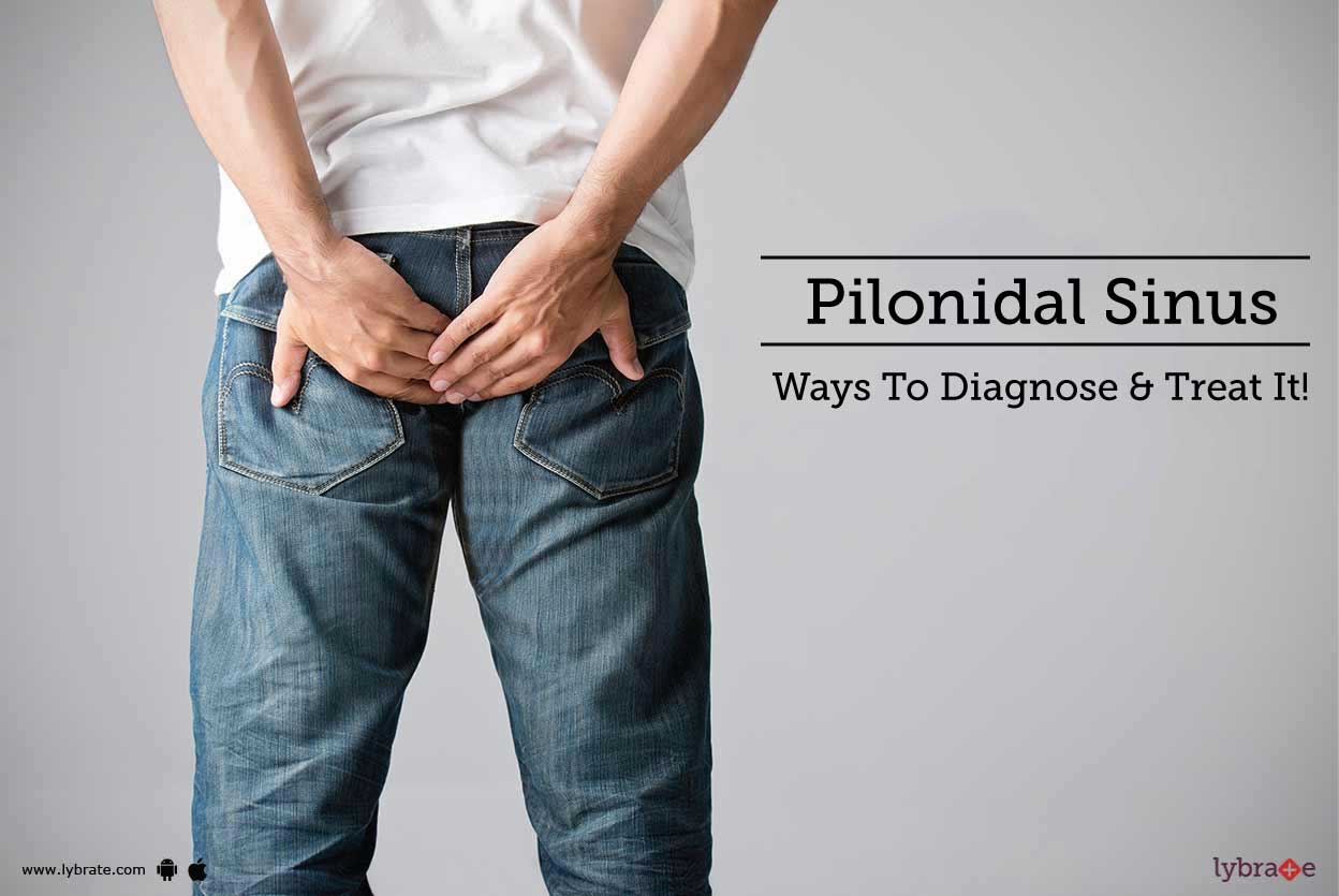 Pilonidal Sinus - Ways To Diagnose & Treat It! - By Dr. Prakash Kotak ...