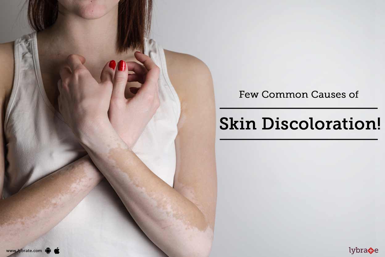 Few Common Causes of Skin Discoloration! - By Dr. Himanshu Singhal ...