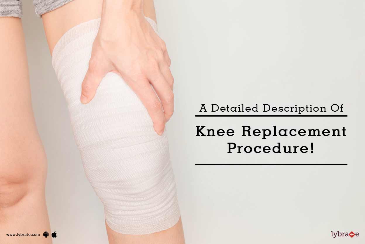 A Detailed Description Of Knee Replacement Procedure! - By Dr. Akash J ...