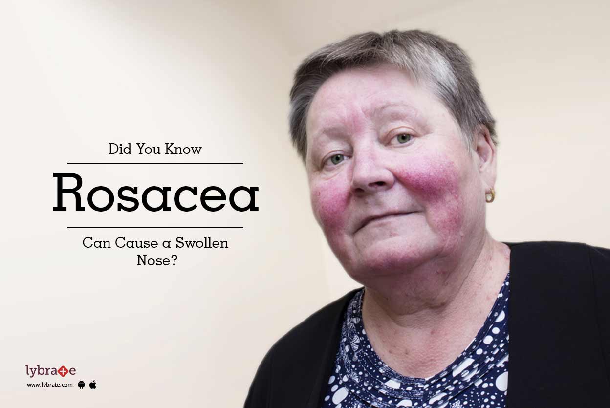 Did You Know Rosacea Can Cause a Swollen Nose? - By Kaya Skin Clinic ...