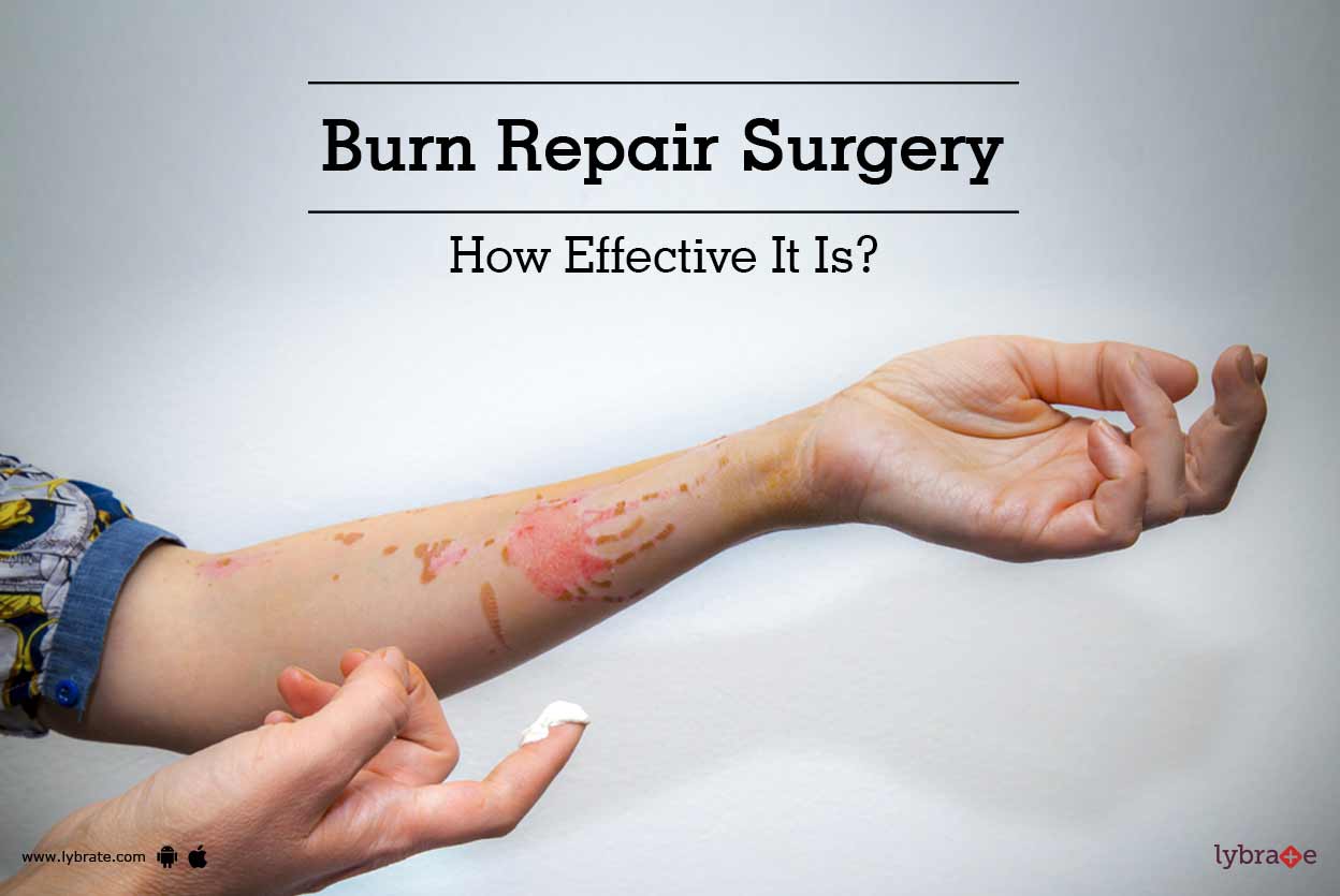 Burn Repair Surgery - How Effective It Is? - By Dr. Sahebgowda Shetty ...