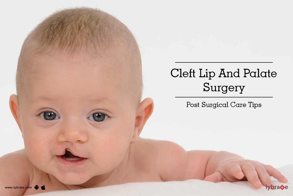 Cleft Lip And Palate Surgery - Post Surgical Care Tips - By Dr. Vijay ...