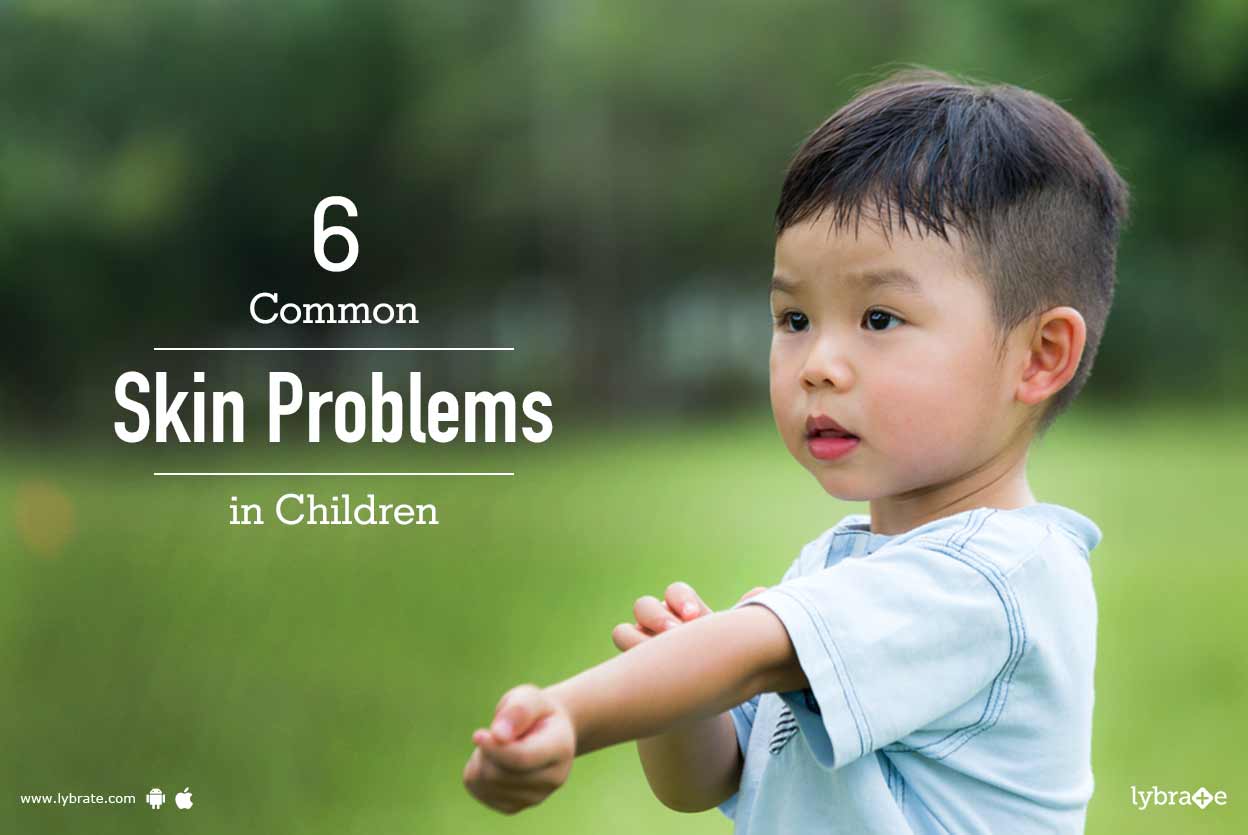 6 Common Skin Problems in Children - By Dr. Dharamvir Singh | Lybrate