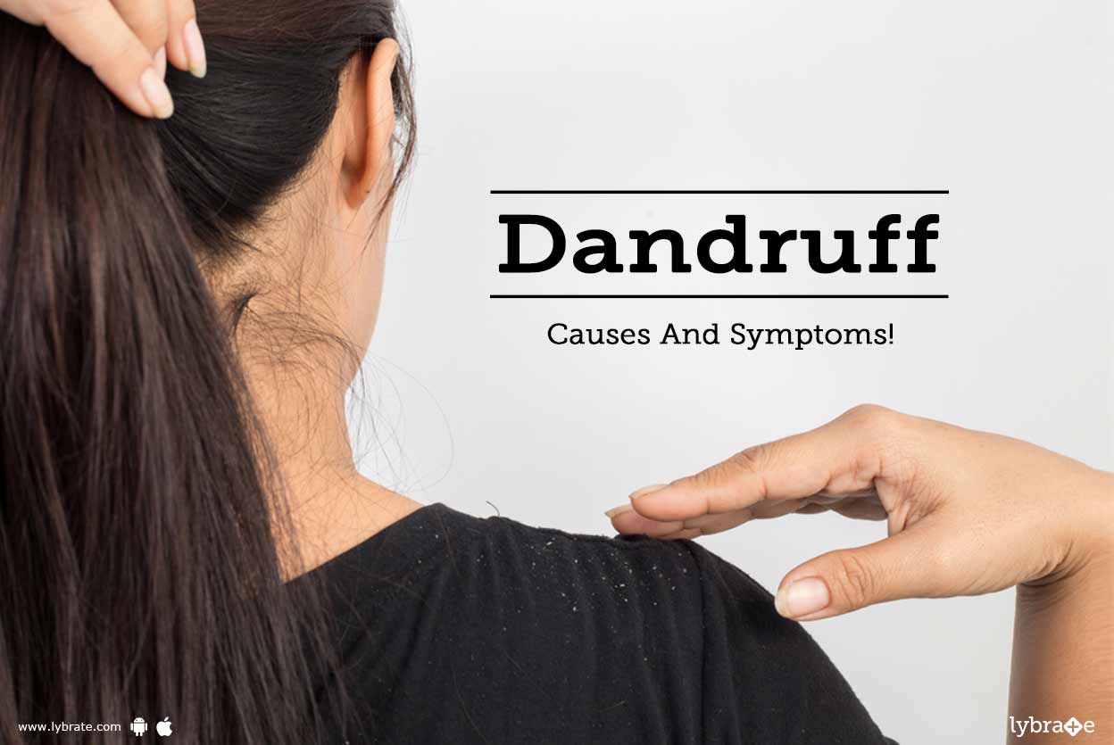 Dandruff - Causes And Symptoms! - By Dr. Anuj Gupta | Lybrate