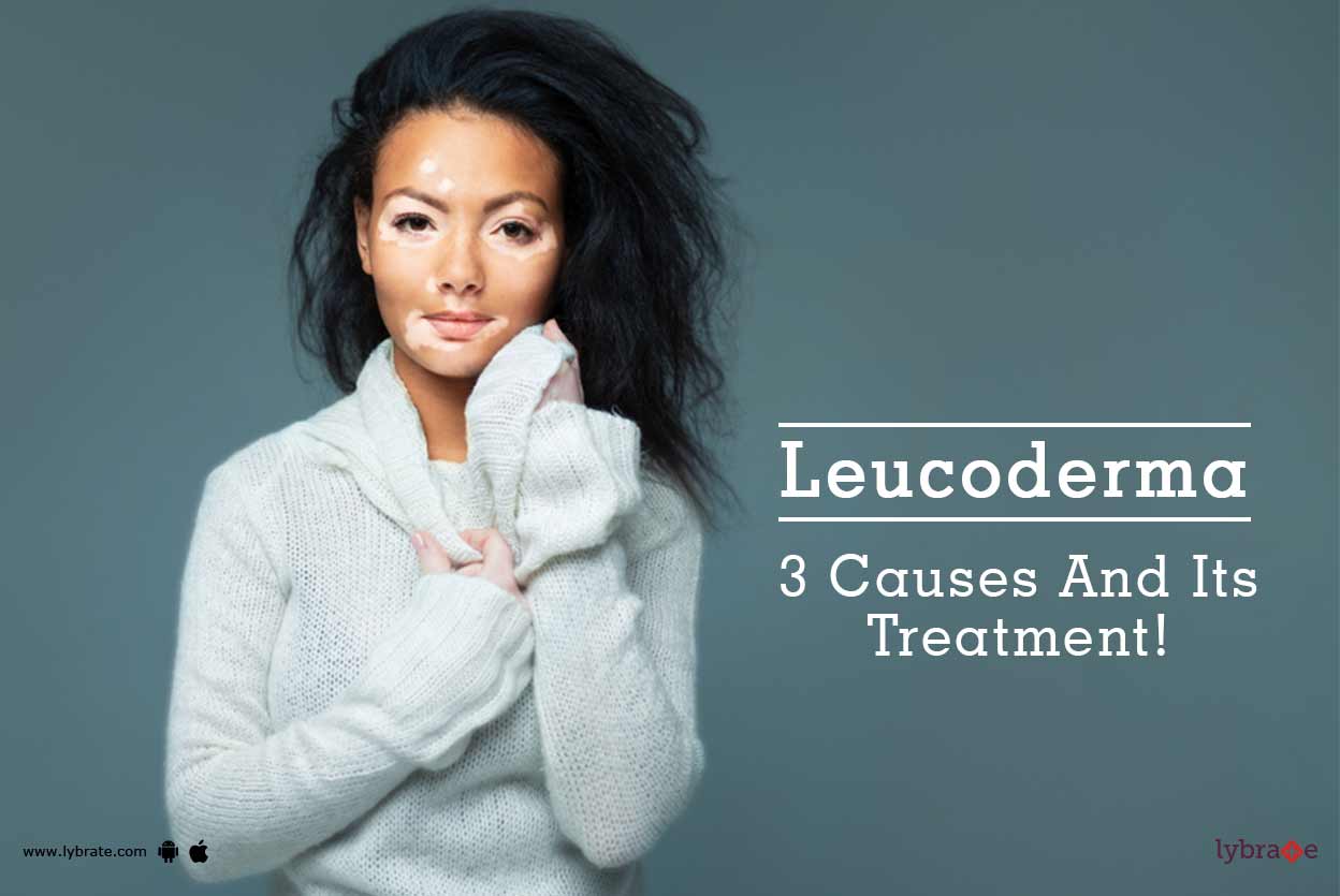 Leucoderma - 3 Causes And Its Treatment! - By Dr. Gaurav Nakra | Lybrate